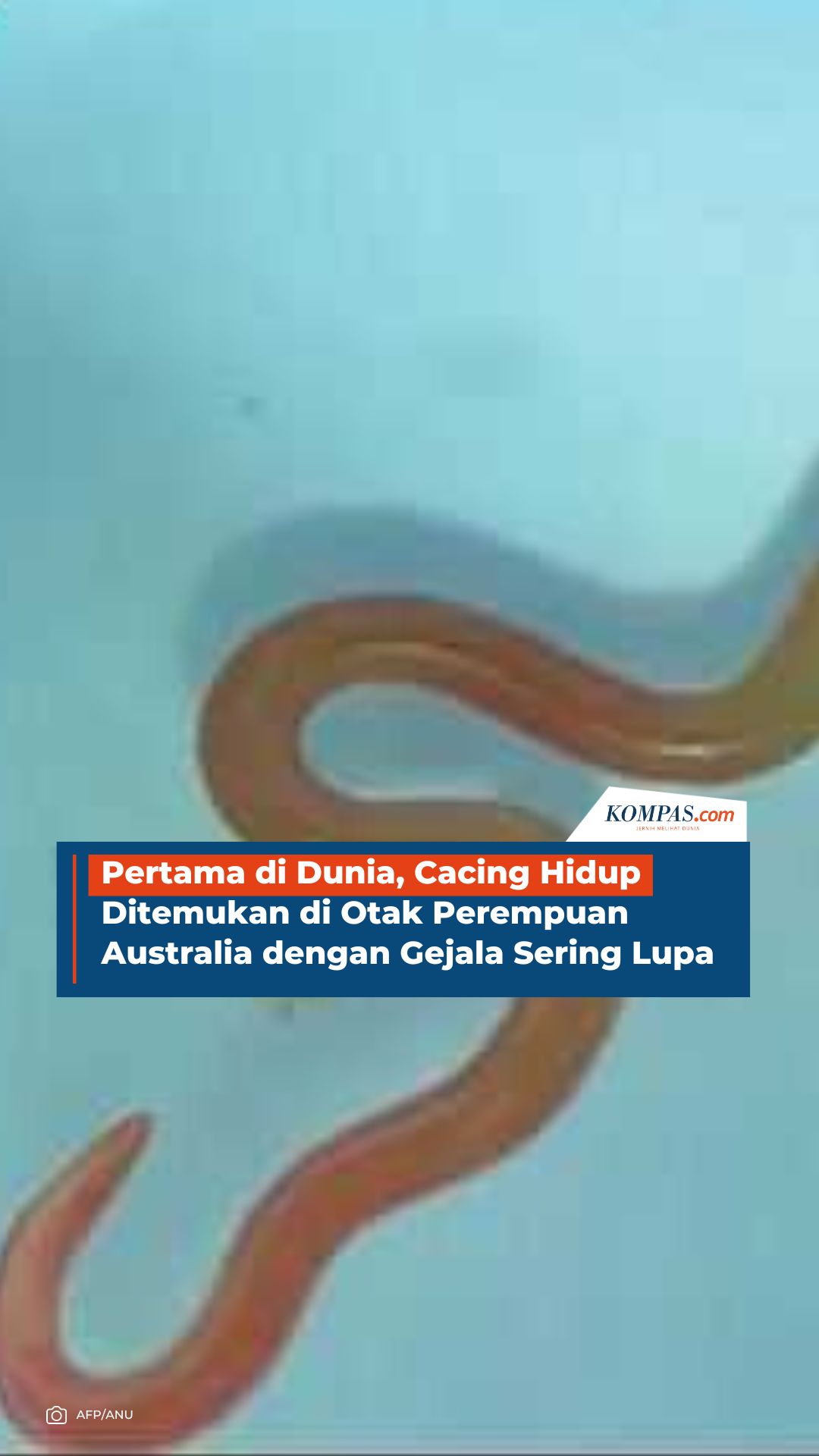 Video: Pertama di Dunia, Cacing Hidup Ditemukan di Otak Perempuan Australia dengan Gejala Sering ...