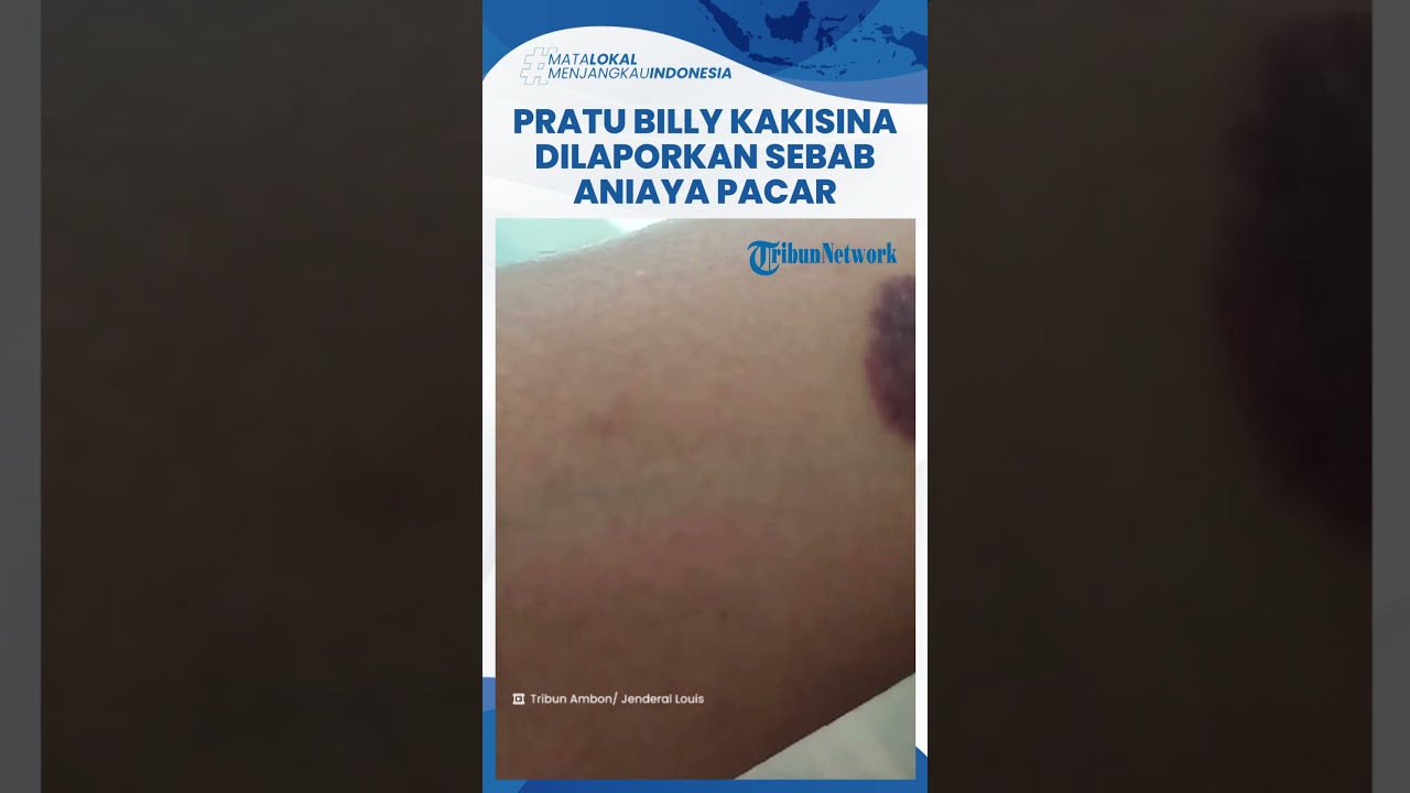 Video: Sempat Terseret Kasus, Pratu Billy Kembali Berulah, Kini ...