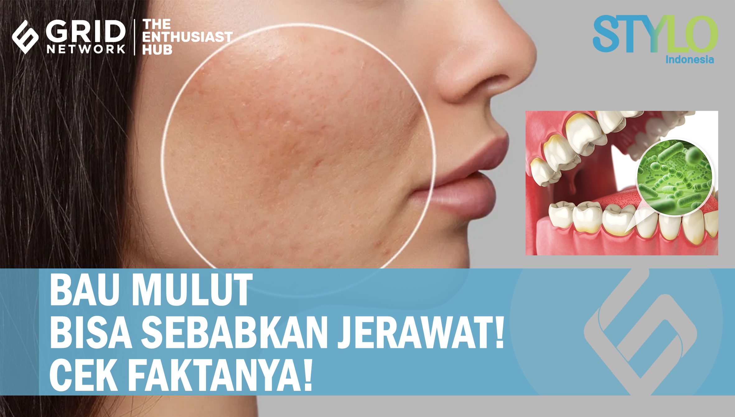 Video: Bau Mulut Ternyata Bisa Sebabkan Jerawat di Wajah! Simak ...
